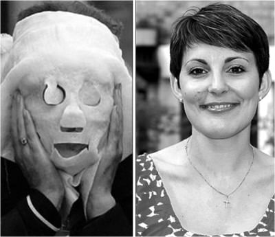 World's first full face transplant successful | The Daily Star