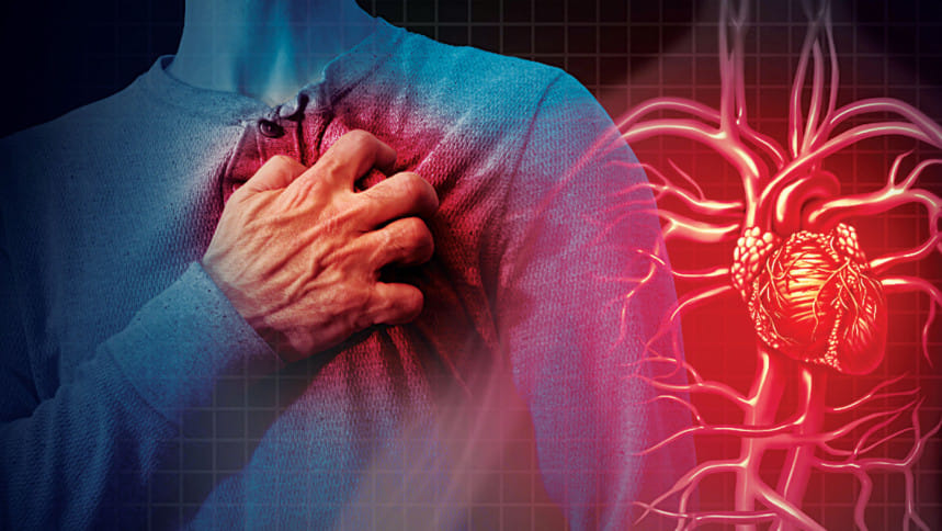 Low- and middle-income nations ill-prepared to combat CVD | The Daily Star