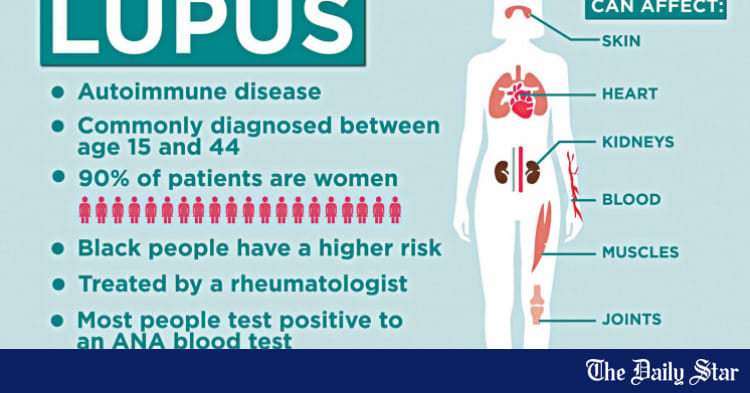 Life after lupus | The Daily Star