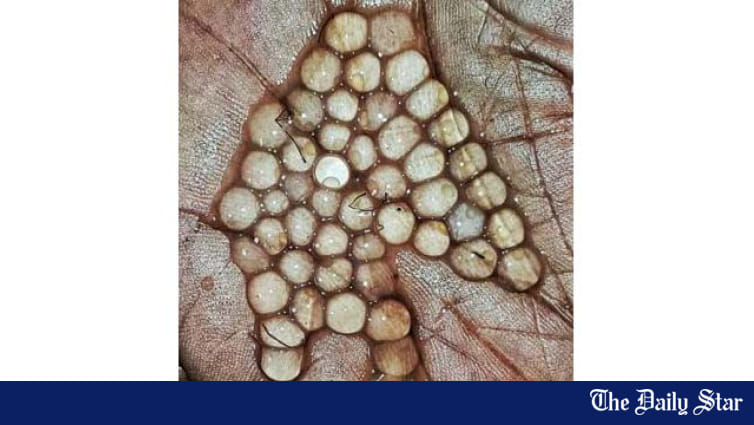 Brood fish releases sample eggs in Halda river | The Daily Star