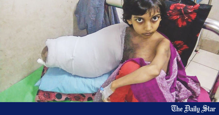 Tree man Disease: Muktamoni waits for miracle