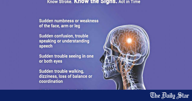 Tips for dealing with stroke | The Daily Star