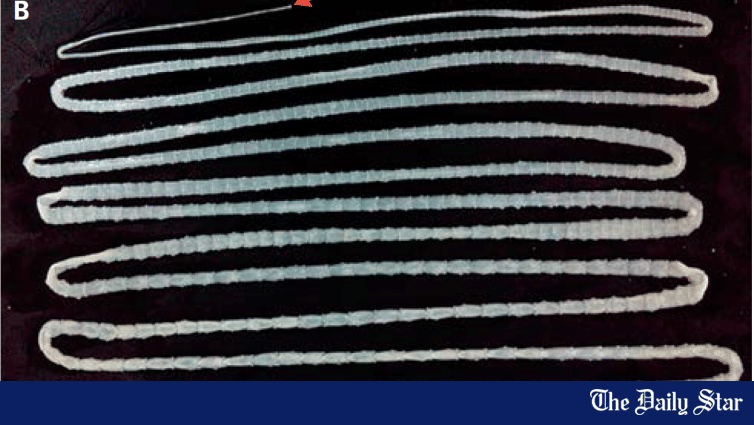 Man gets 20-foot tapeworm from eating raw meat | The Daily Star
