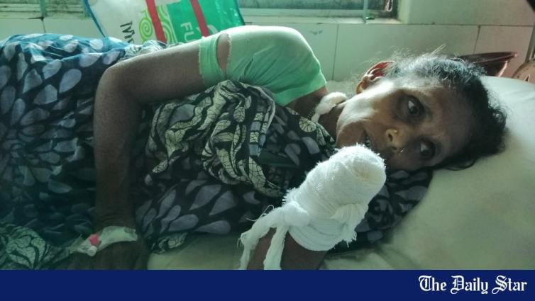 Woman’s hand chopped off during villagers’ clash | The Daily Star