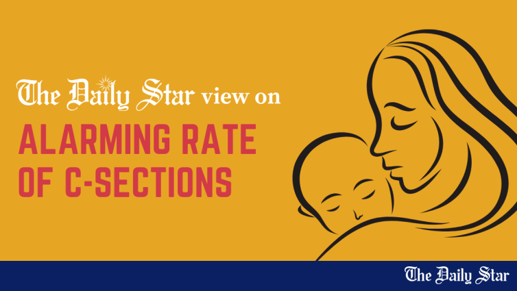 Why are C-sections on the rise? | The Daily Star