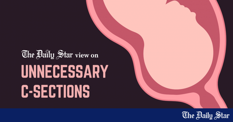 The concerning rise of C-sections | The Daily Star