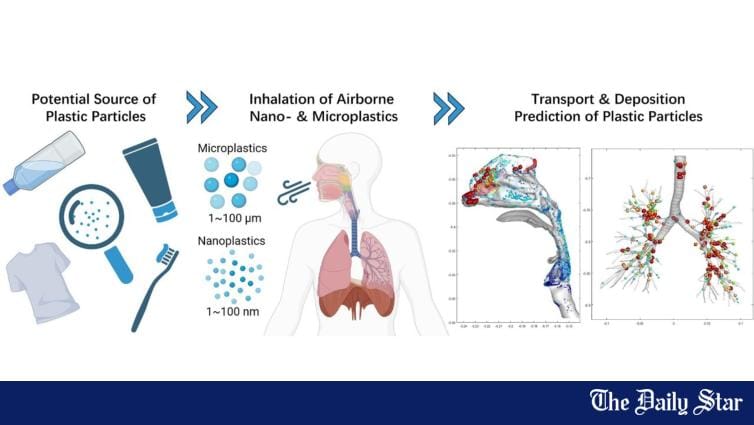 Nano, microplastics accumulating in our lungs: Study | The Daily Star